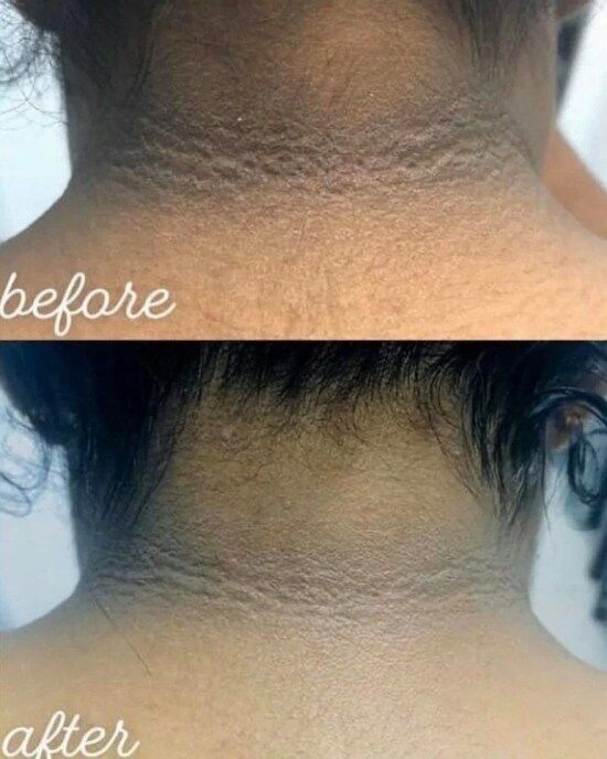 Intimate Area Bleaching | Montego Bay Jamaica - Real Styling Solutions